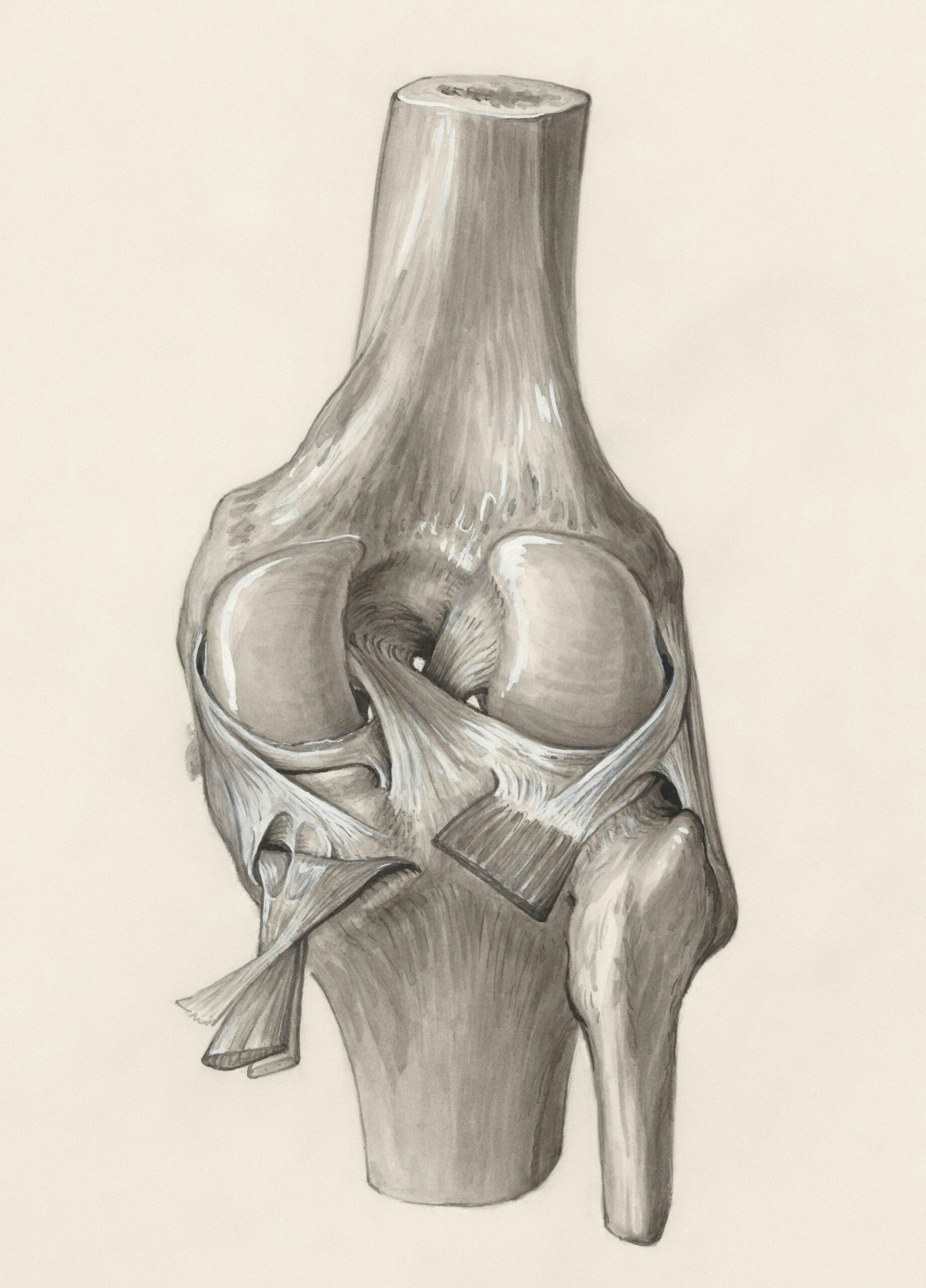 Pain Behind Knee When Bending the Leg? Causes and Treatment Options